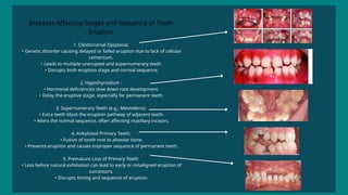 stage and sequence of teeth eruption.pptx.pptx