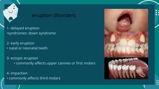 stage and sequence of teeth eruption.pptx.pptx