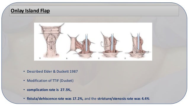 Staged urethroplasty decision making