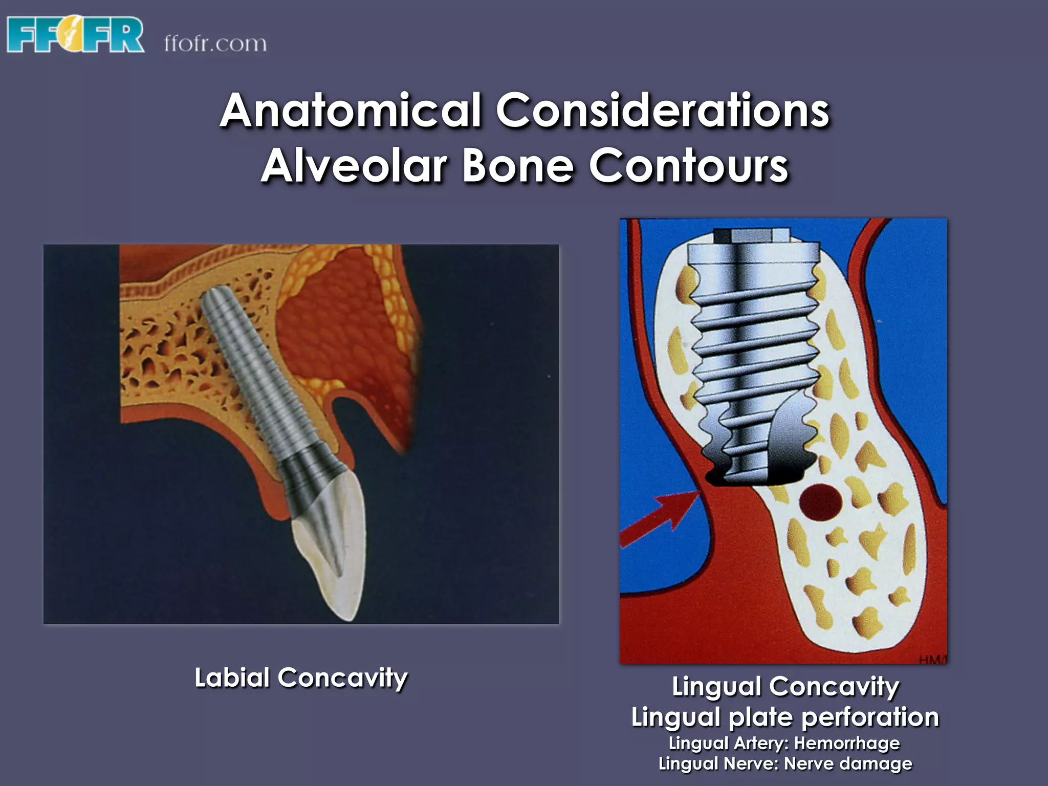Stage i & ii surgery | PDF