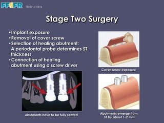Stage i & ii surgery | PDF
