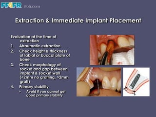 Stage i & ii surgery | PDF