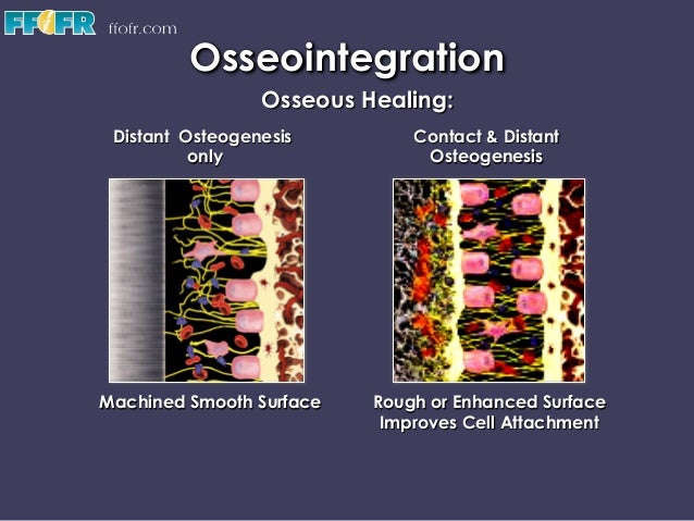 Stage i & ii surgery