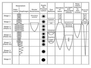Stage of anesthesia | PPTX