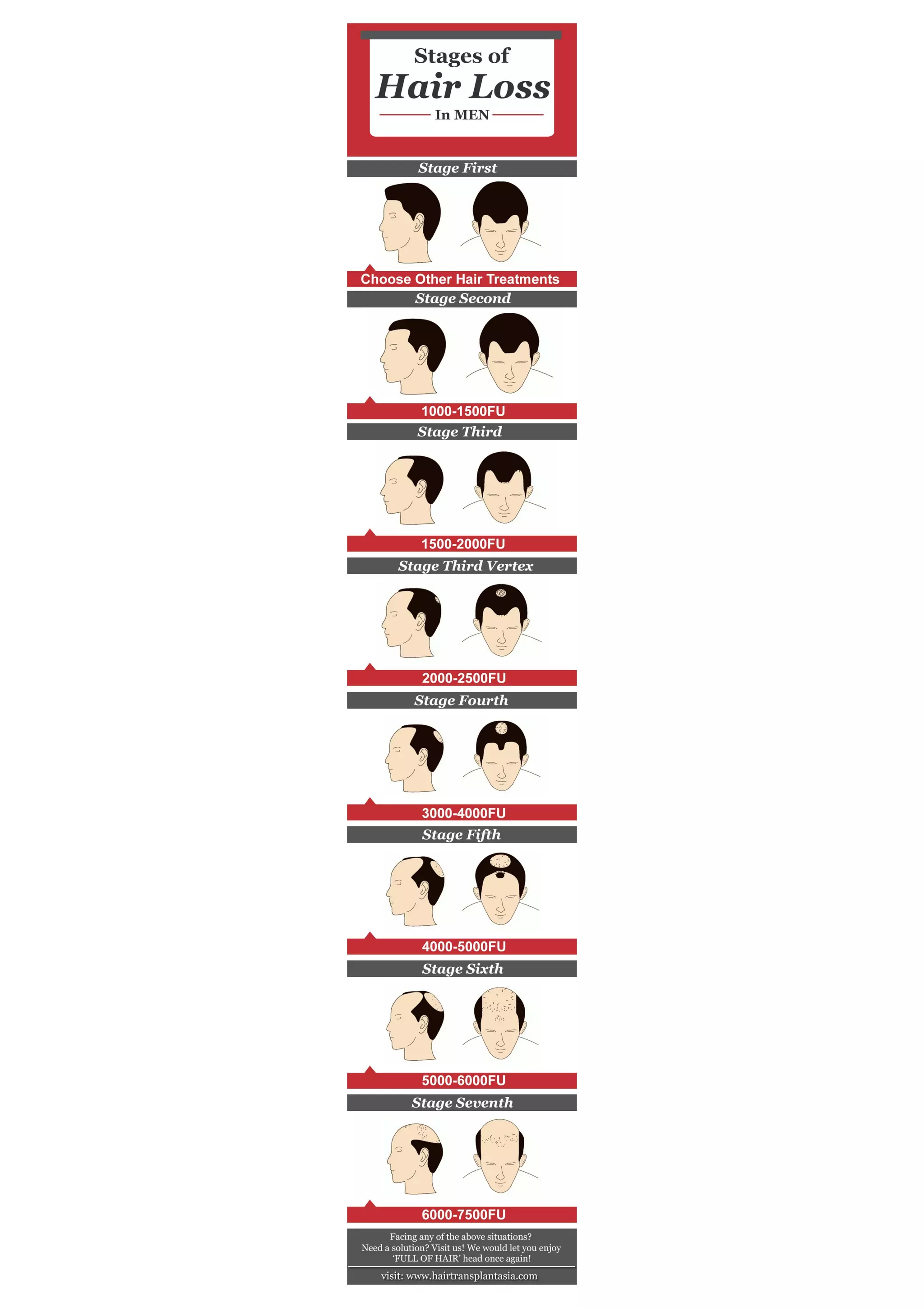 Stages of Hair Loss in Men | PDF