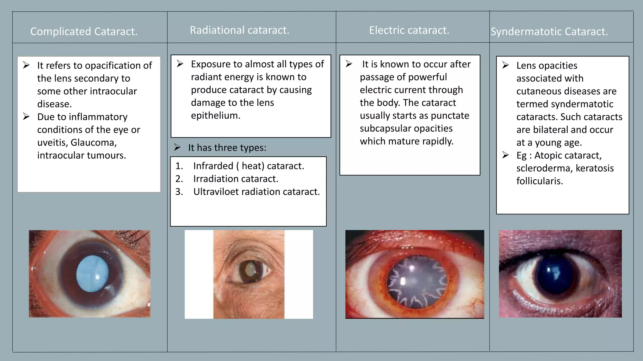 Stages and clinical features of cataract.pptx