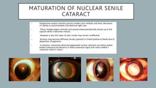 Stages and clinical features of cataract.pptx