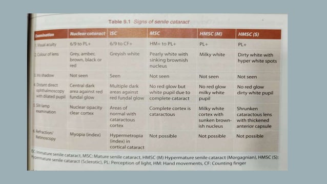 Stages and clinical features of cataract.pptx | Eye and Vision ...
