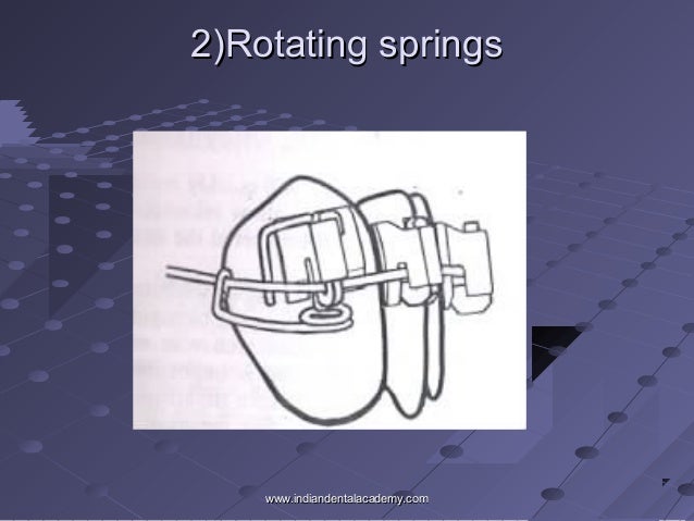 Stages in beggs technique /certified fixed orthodontic courses by Ind…