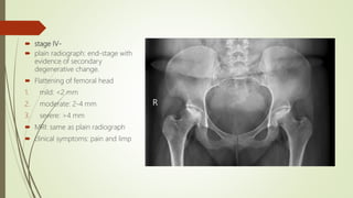 STAGES OF AVN | PPTX