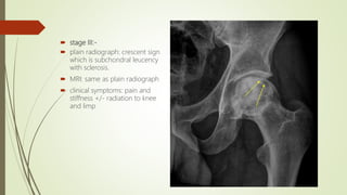 STAGES OF AVN | PPTX
