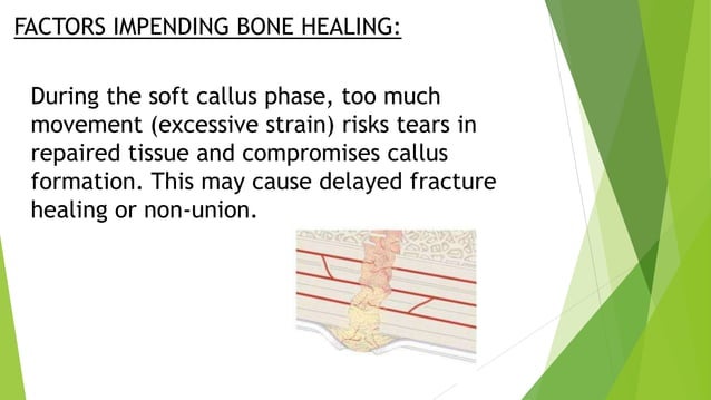 Stages of bone healing and various factors | PPTX