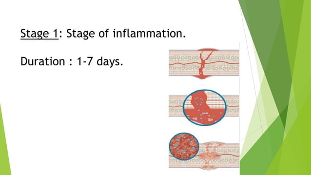 Stages of bone healing and various factors | PPTX
