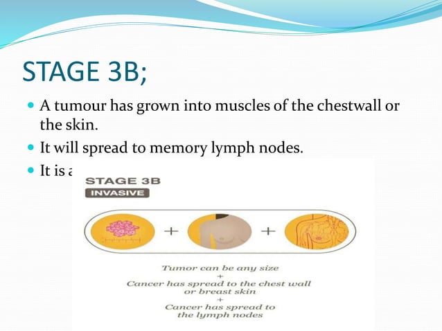 Stages of breast cancer | PPTX