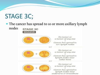 Stages of breast cancer | PPTX