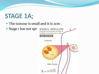 Stages of breast cancer | PPTX