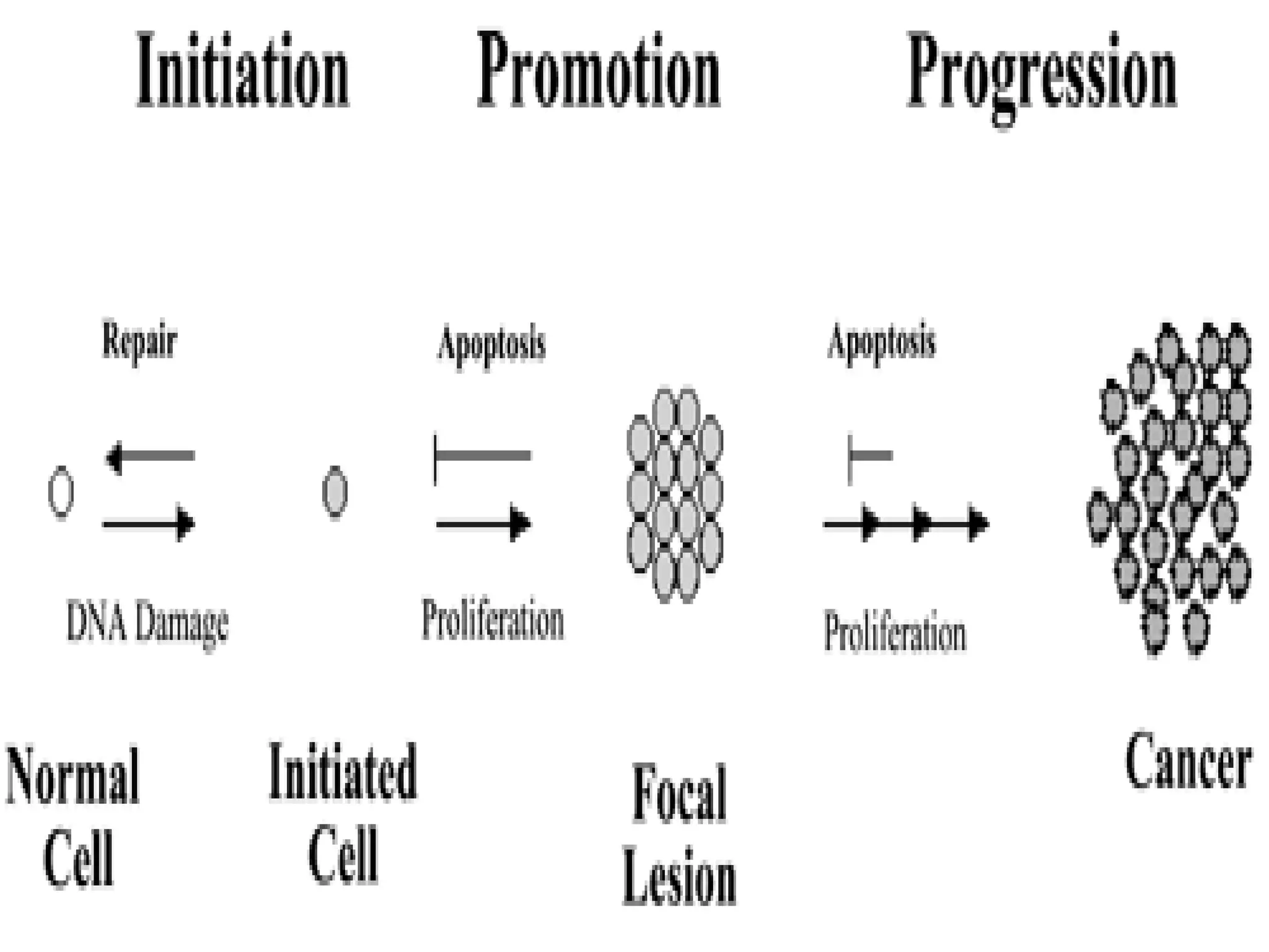 Stages of carcinogenesis | PPT