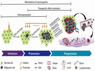 Stages of carcinogenesis | PPT