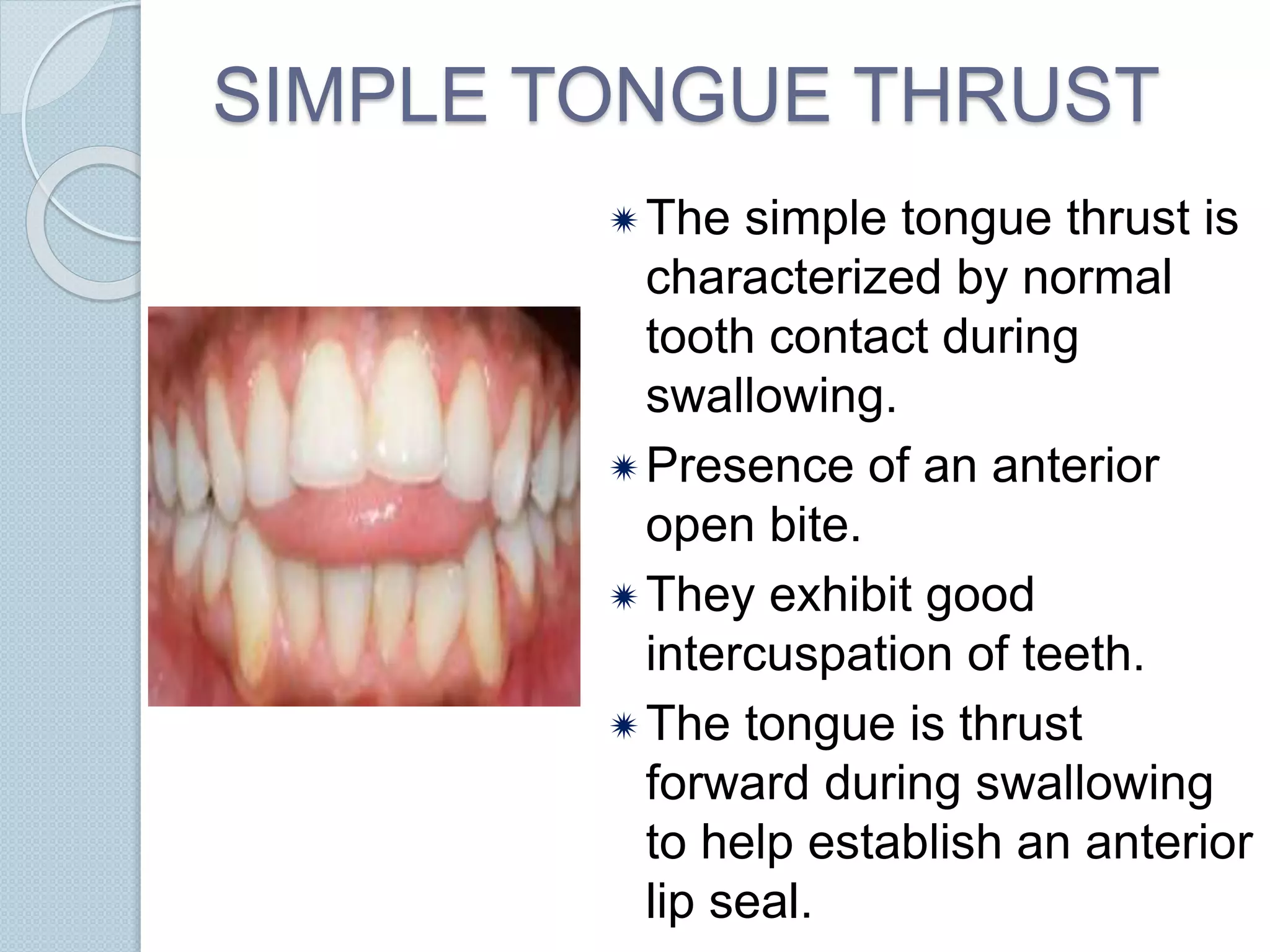 Stages of deglutition and tongue thrusting | PPTX