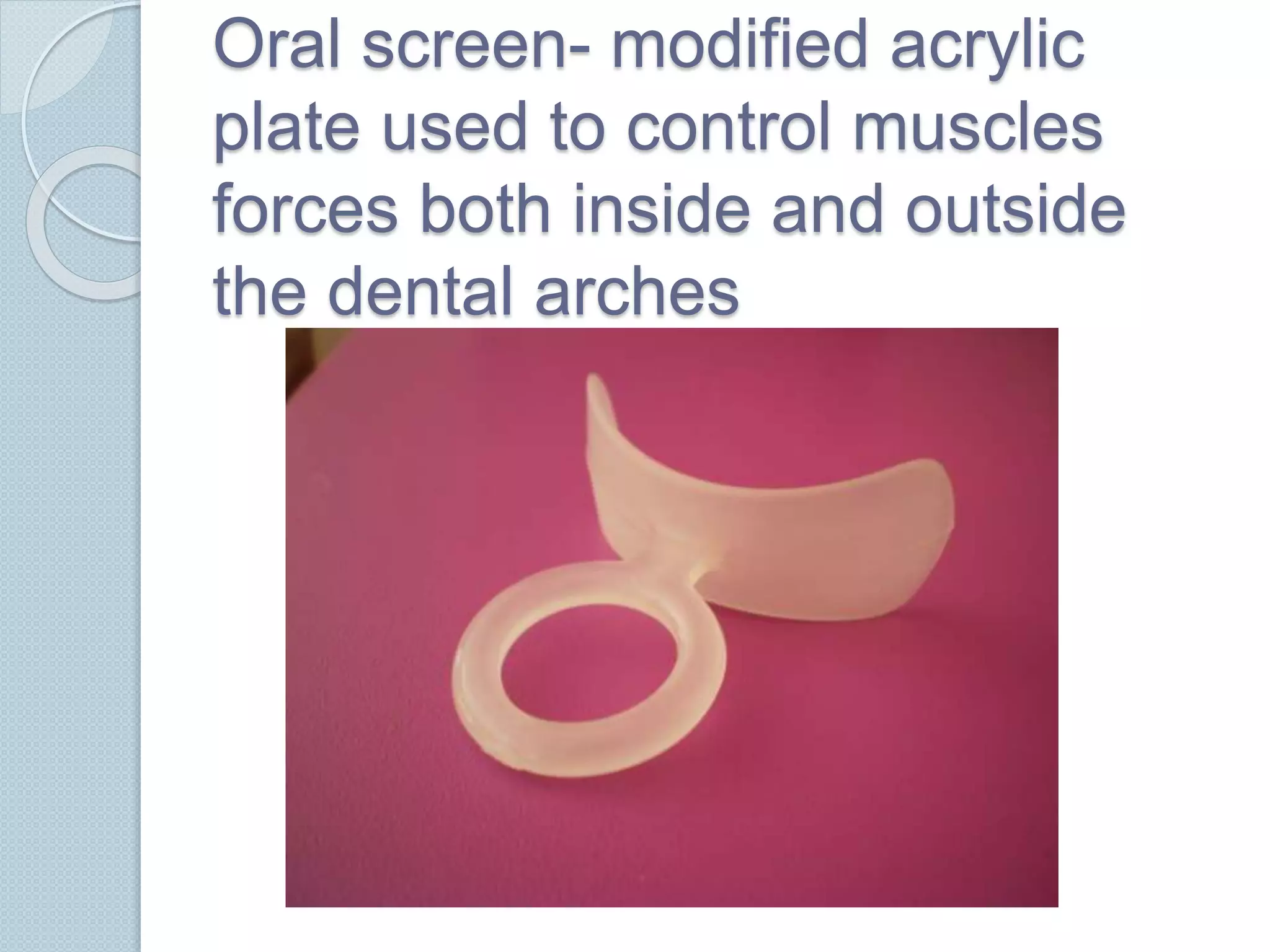 Stages of deglutition and tongue thrusting | PPTX