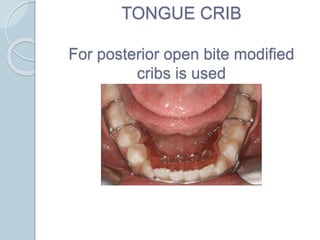 Stages of deglutition and tongue thrusting | PPTX