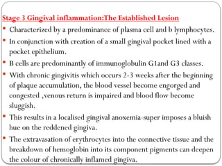 Gingival inflammation-Stages of Gingivitis.pptx