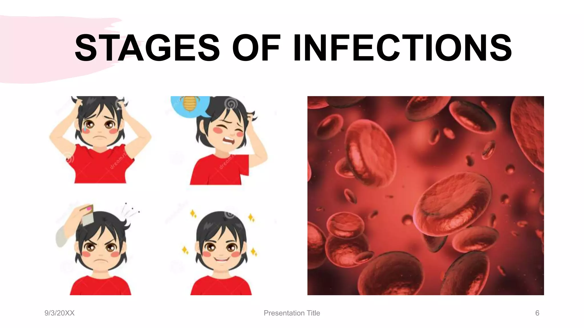 STAGES OF INFECTIONS.pptx