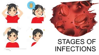 STAGES OF INFECTIONS.pptx