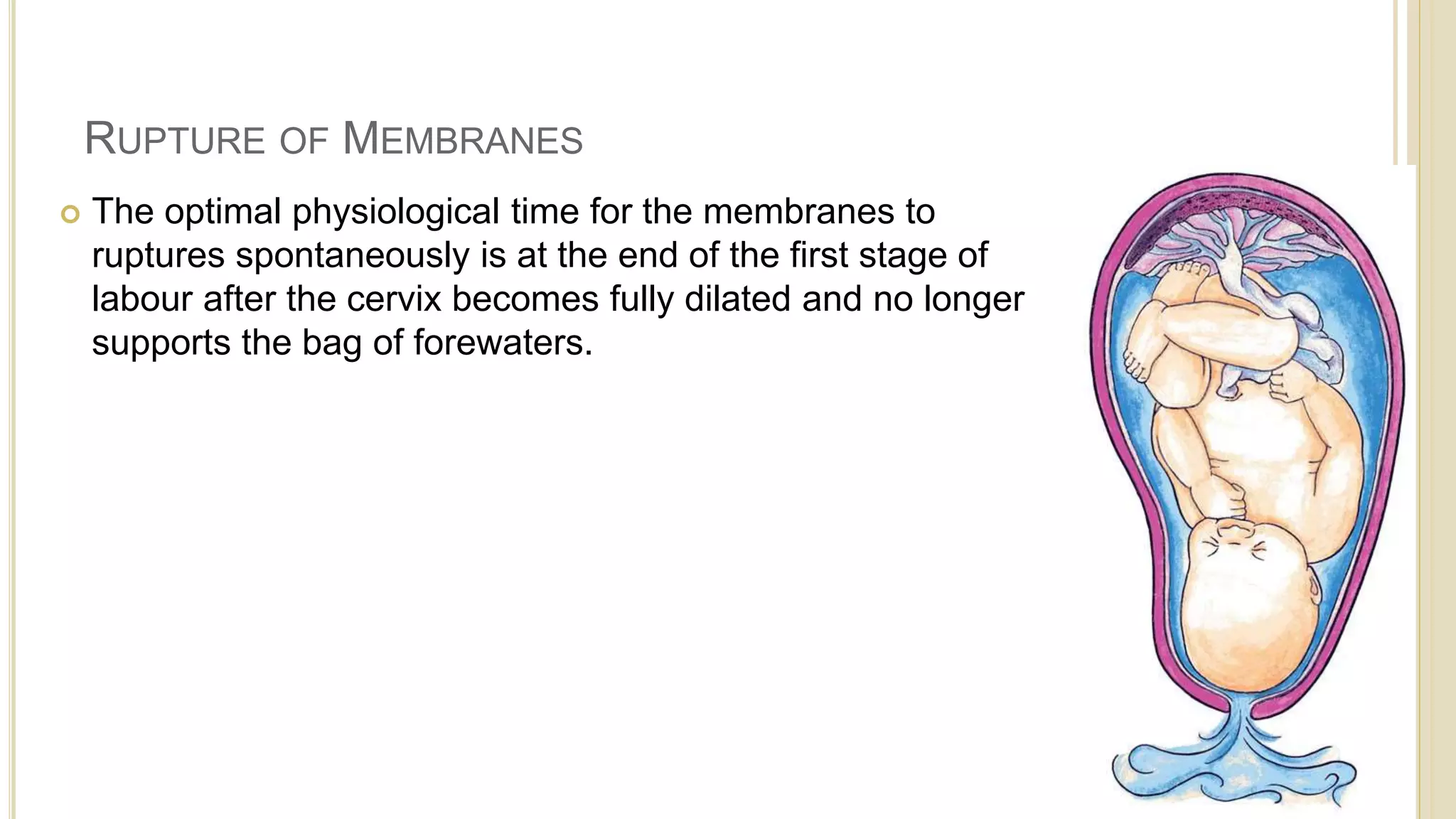 Stages of labour | PPTX