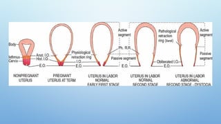 Stages of labour presentation in obstetrics.pptx