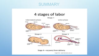 Stages of labour presentation in obstetrics.pptx