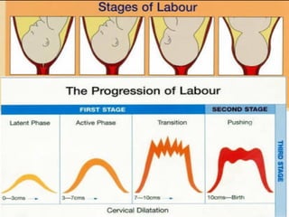 Stages of labour and alternative therapies | PPT