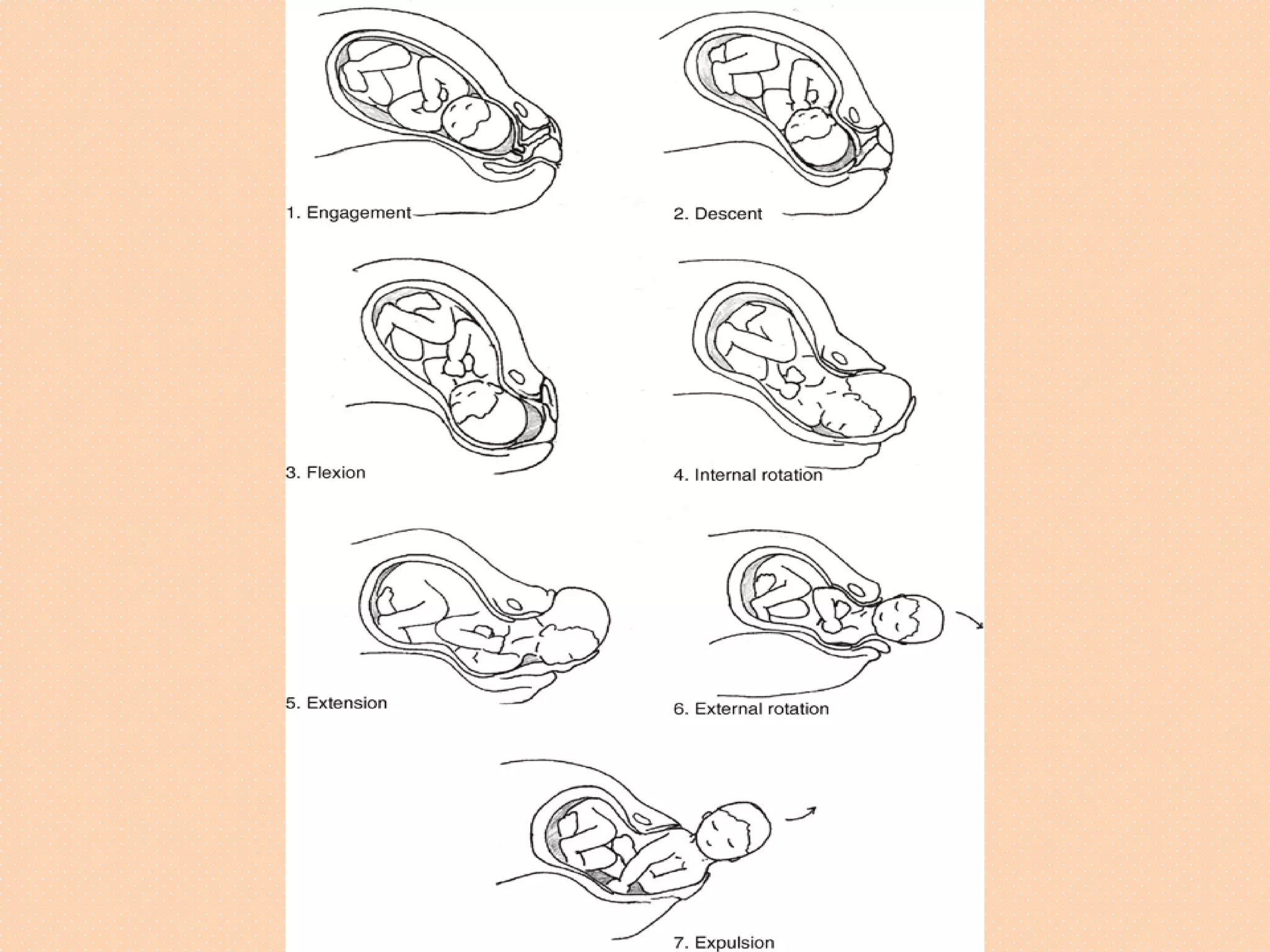 Stages of Normal Labor- easy explanation | PDF