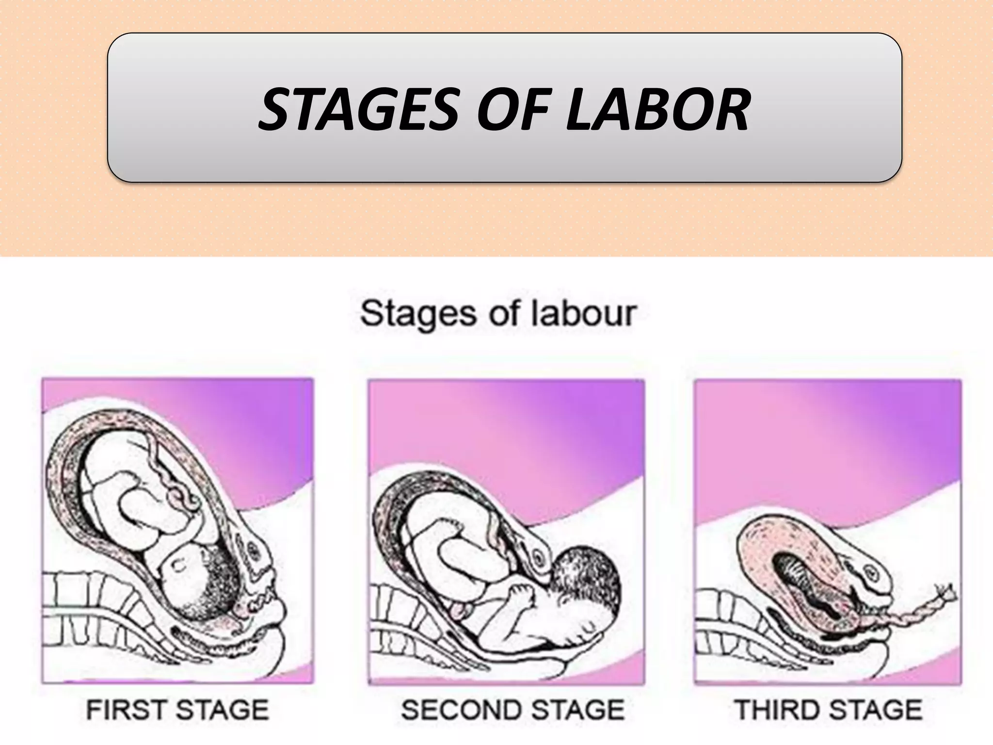 Stages of Normal Labor- easy explanation | PDF