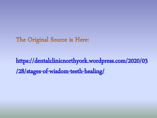 Stages of Wisdom Teeth Healing | PPTX | Dental Health | Diseases and ...