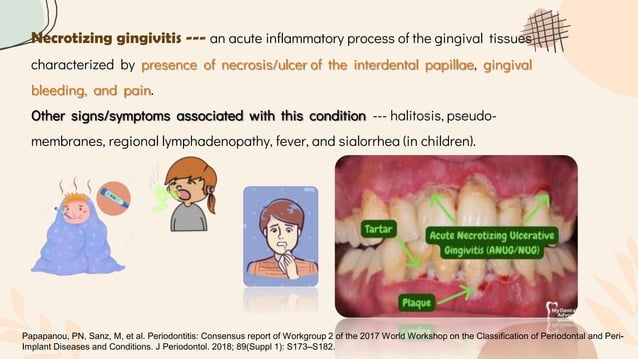 STAGING AND GRADING IN PERIODONTITIS.pptx | Dental Health | Diseases ...