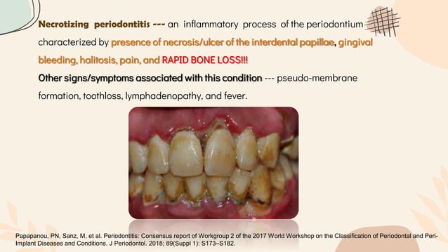 STAGING AND GRADING IN PERIODONTITIS.pptx | Dental Health | Diseases ...