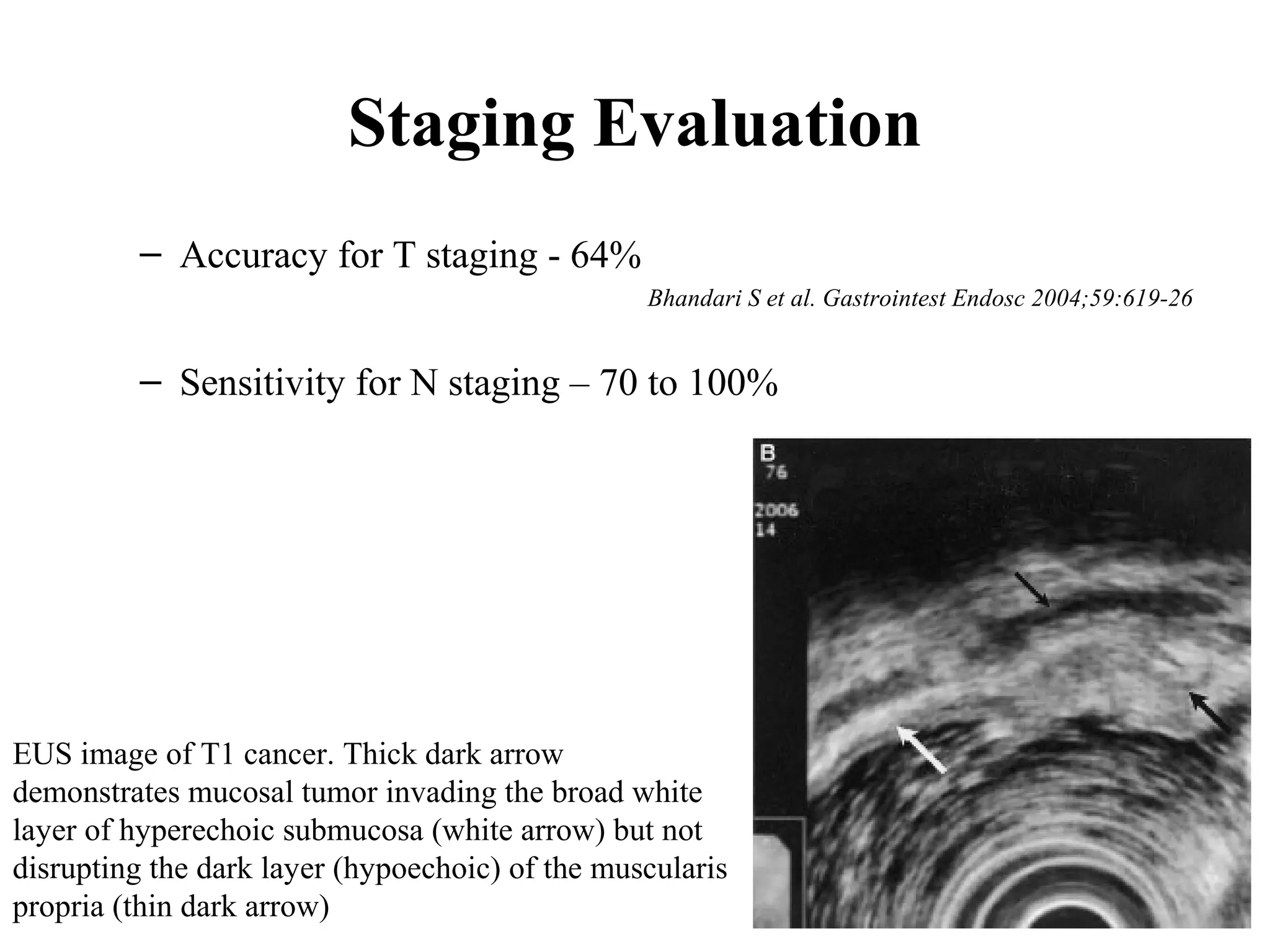 Staging and surgery of gastric carcinoma | PPT