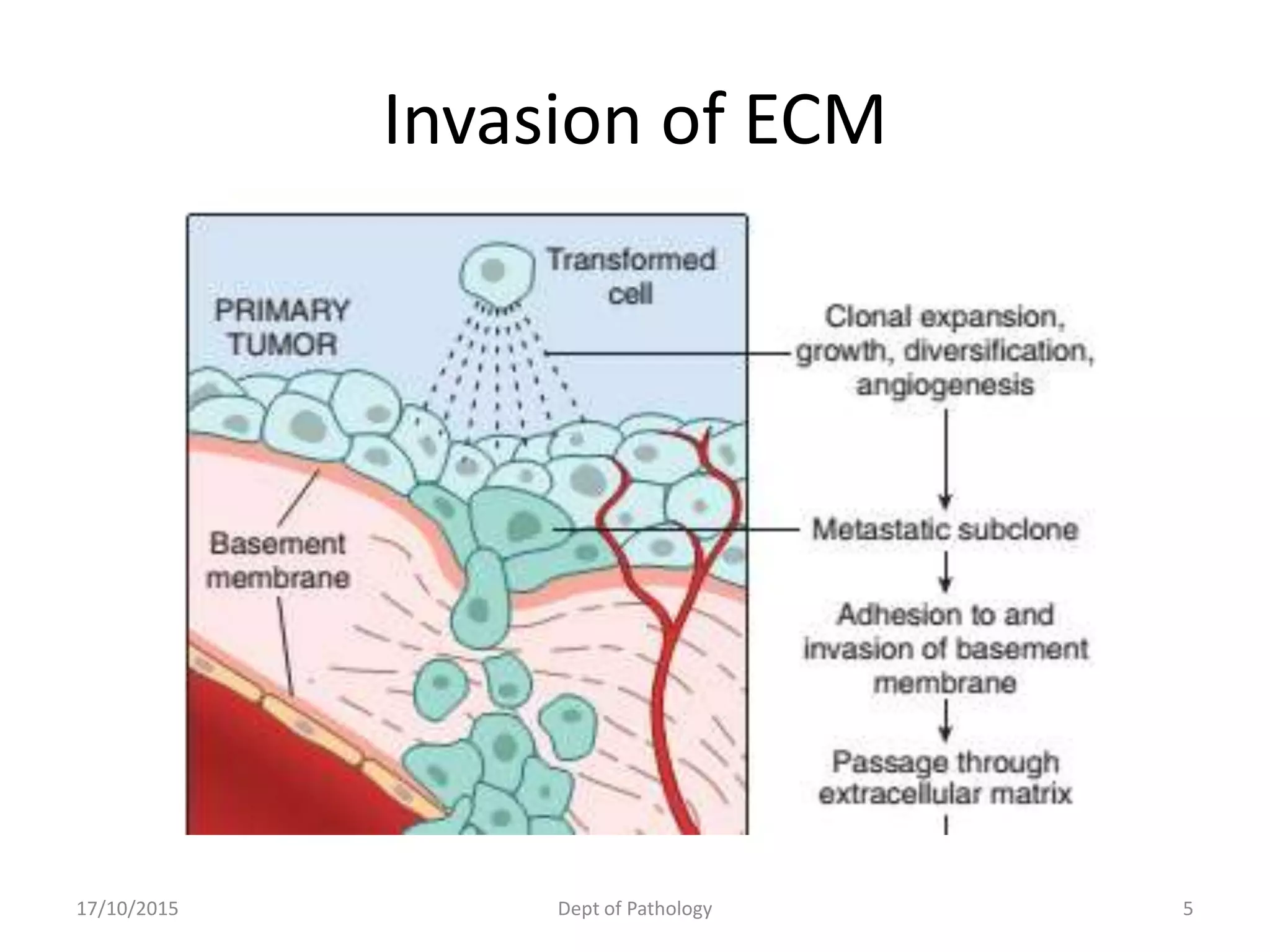 Staging grading and spread of tumors | PPTX | Cancer | Diseases and ...