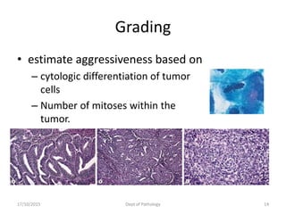 Staging grading and spread of tumors | PPTX