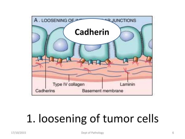 Staging grading and spread of tumors | PPT