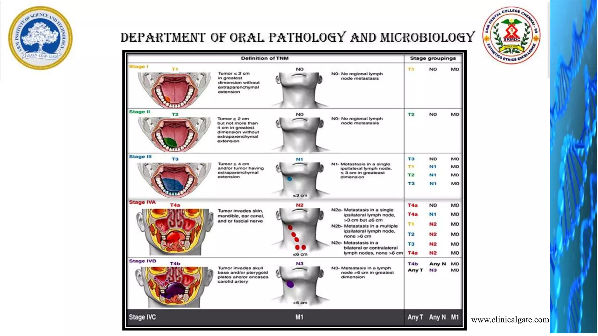 Staging & Grading of oral cancer | PPTX