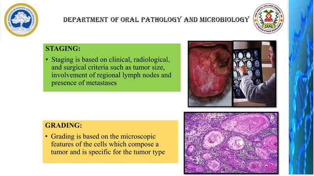 Staging & Grading of oral cancer | PPTX | Cancer | Diseases and Conditions