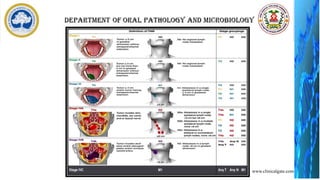 Staging & Grading of oral cancer | PPTX