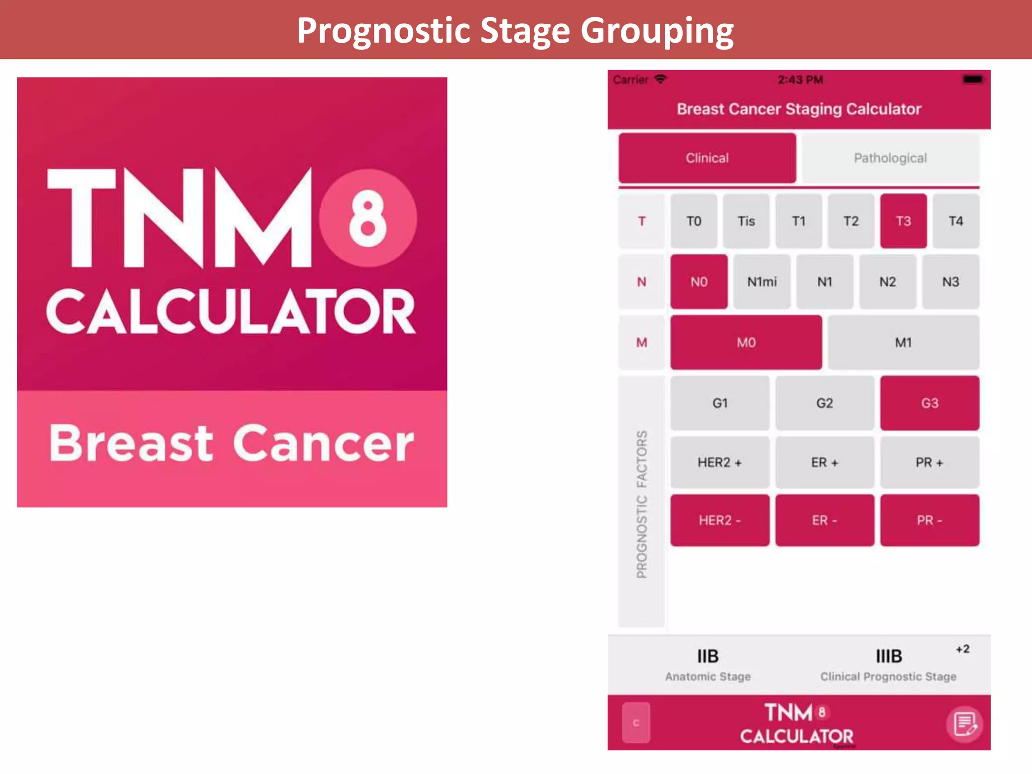 Staging of breast cancer | PPTX
