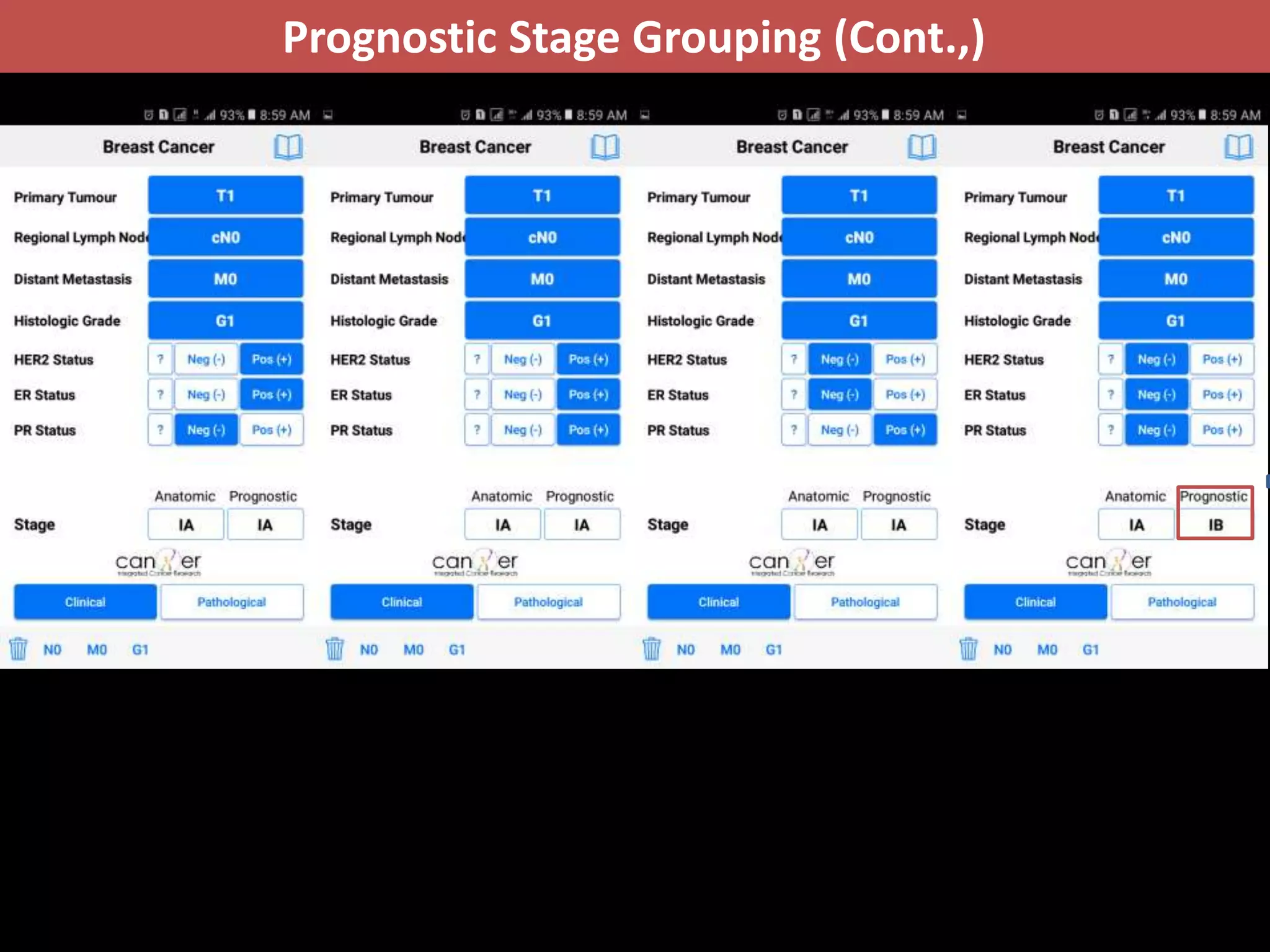 Staging of breast cancer | PPTX