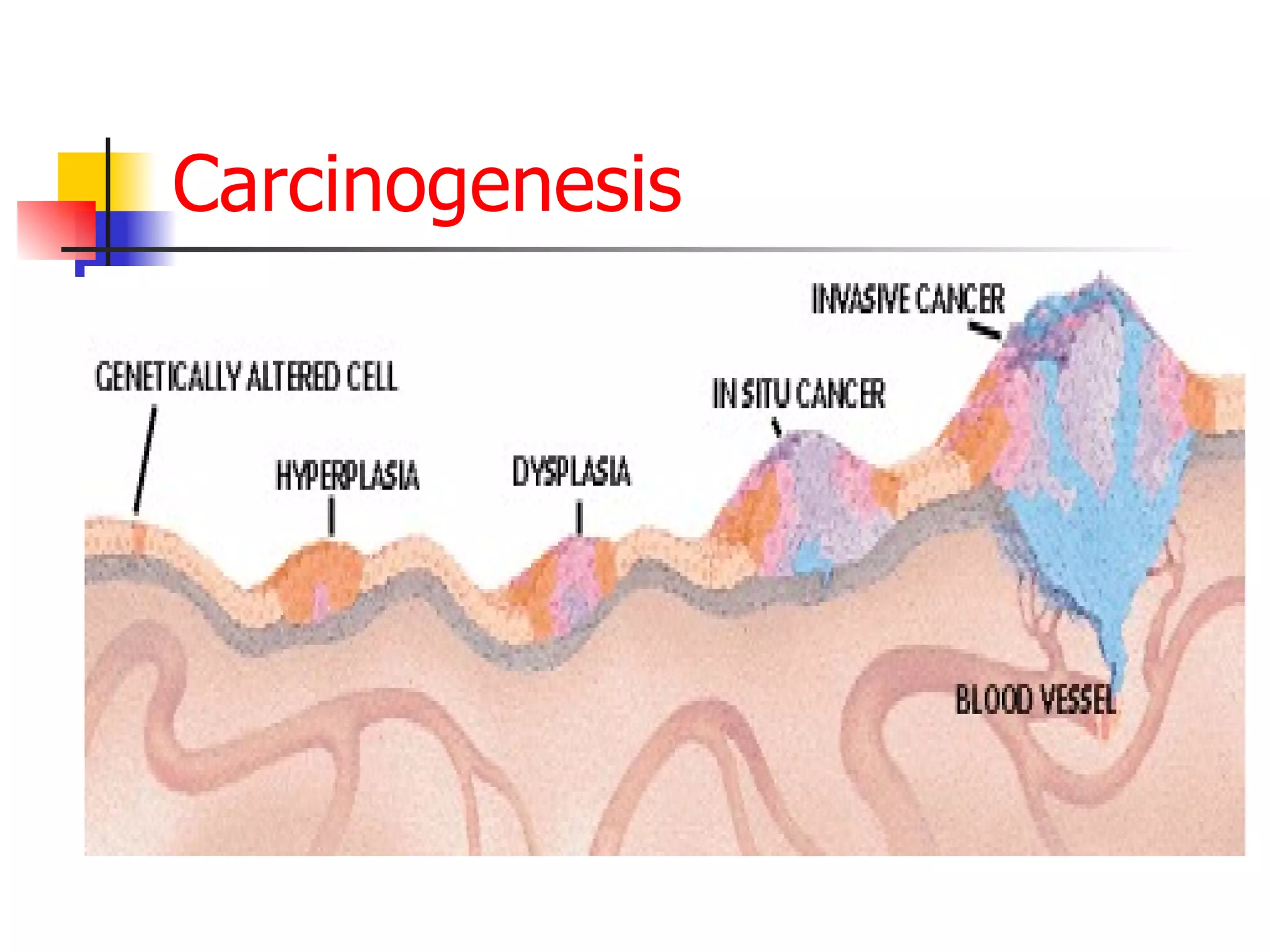 Staging of cancer | PPT