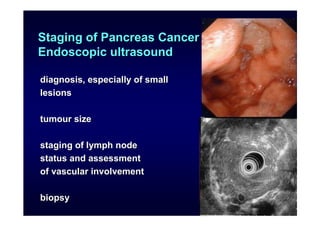 Staging and Surgical Management of Pancreatiic Cancer | PDF