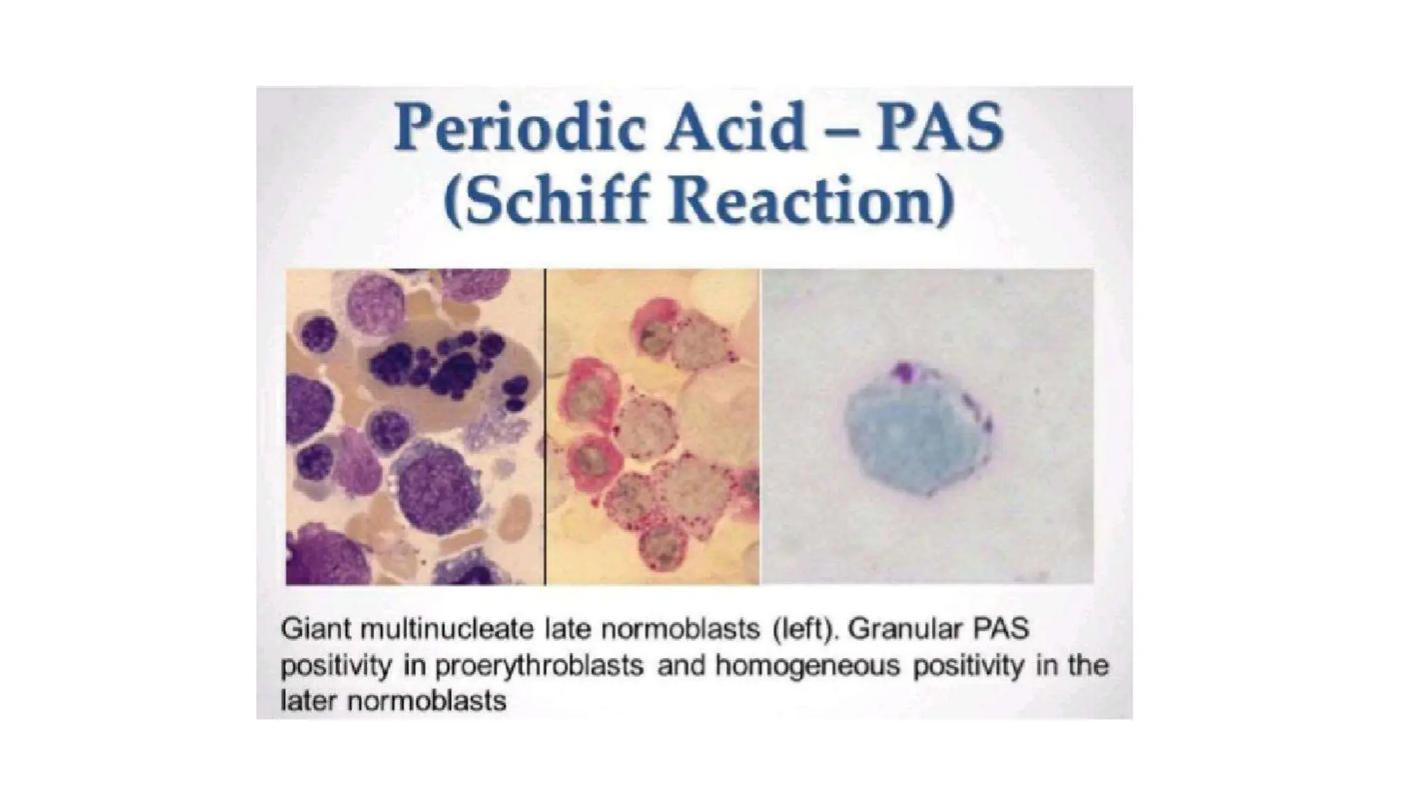 Stains and staining procedures in Pathology pptx | PPT