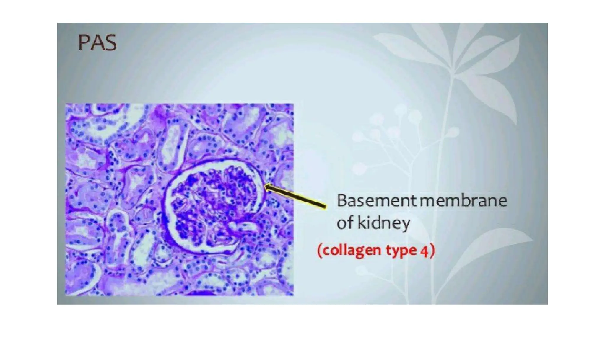 Stains and staining procedures in Pathology pptx | PPT